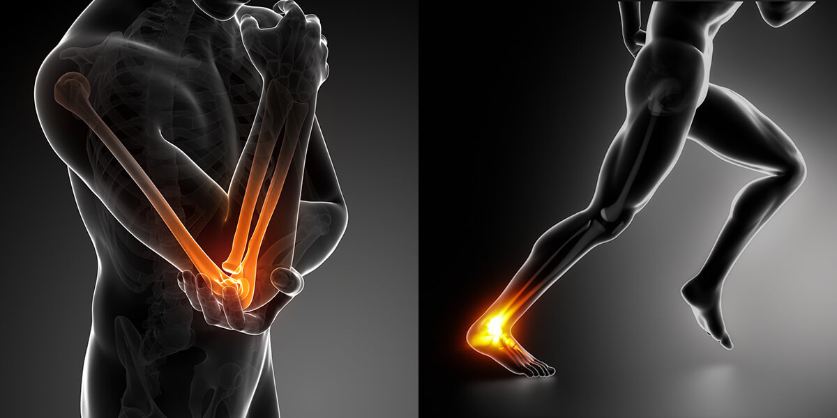 Tenex Health TX™ for Chronic Tendon Disease • News • Community Care ...