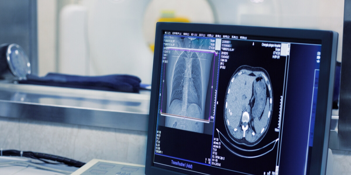 Schenectady Radiology is now part of ImageCare Medical Imaging • News ...