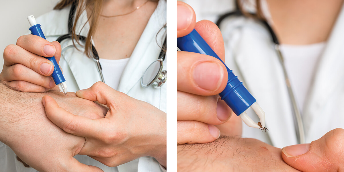 Make Your Own Tick Kit • Health Blog • Community Care Physicians